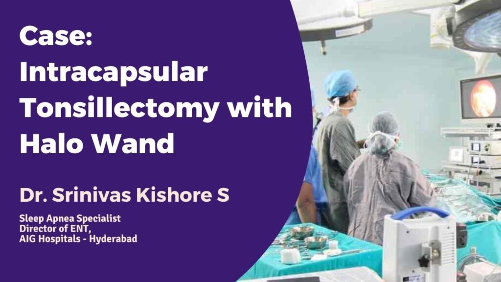 Intracapsular Tonsillectomy: A Minimally Invasive Tonsillectomy ...
